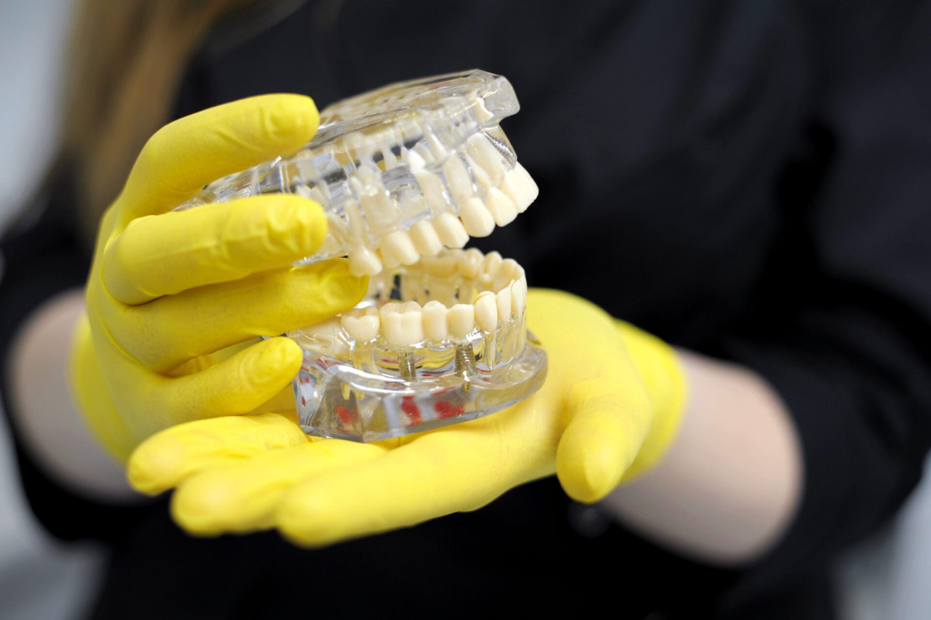 The Science Behind Toothpaste: How Fluoride Works to Prevent Cavities ...